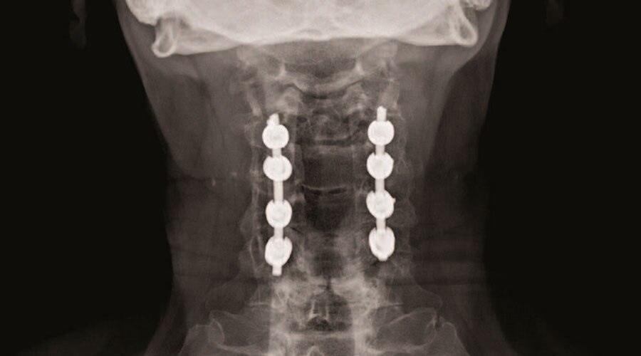 Discovery RF180 Röntgen- und Durchleuchtungssystem | GE Healthcare