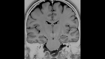 NeuroWorks | GE Healthcare