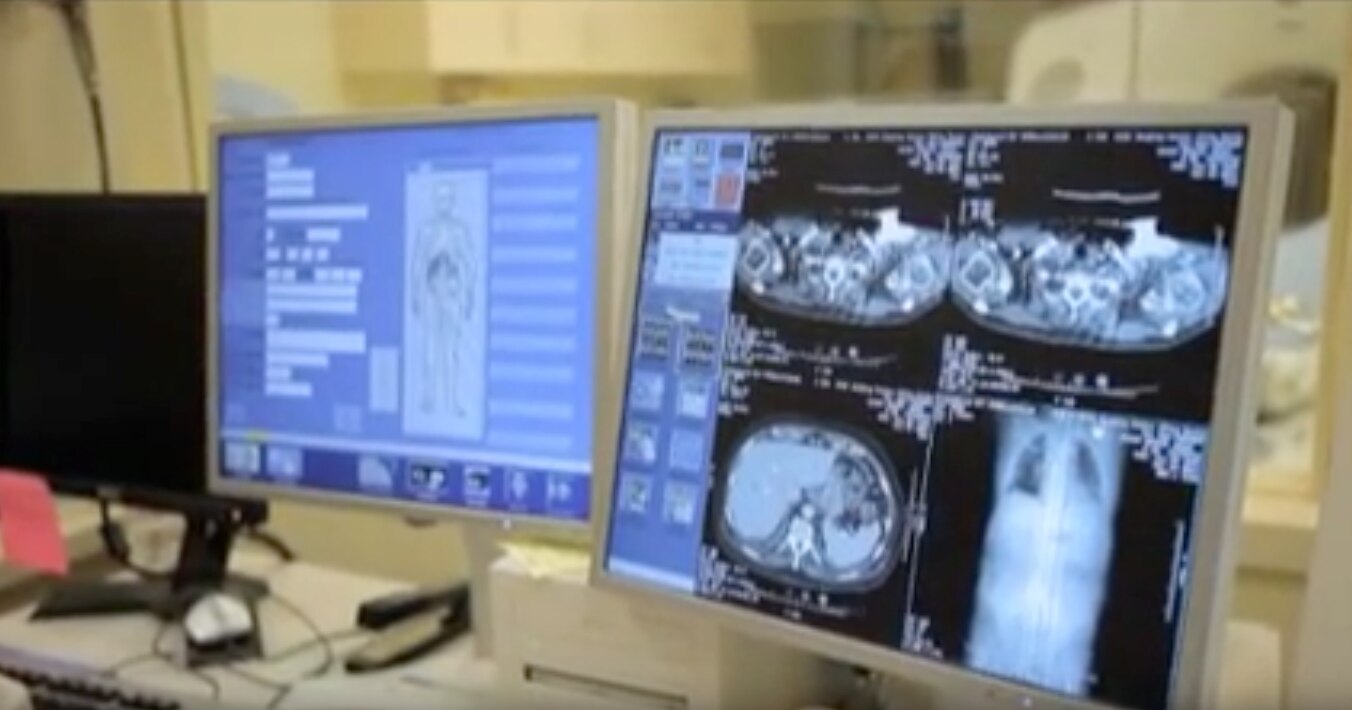 Dosismanagement | GE Healthcare