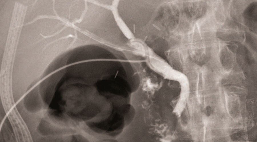 Discovery RF180 Röntgen- und Durchleuchtungssystem | GE Healthcare