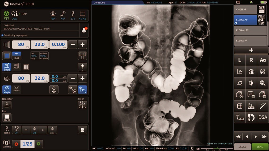 Discovery RF180 Röntgen- und Durchleuchtungssystem | GE Healthcare ...