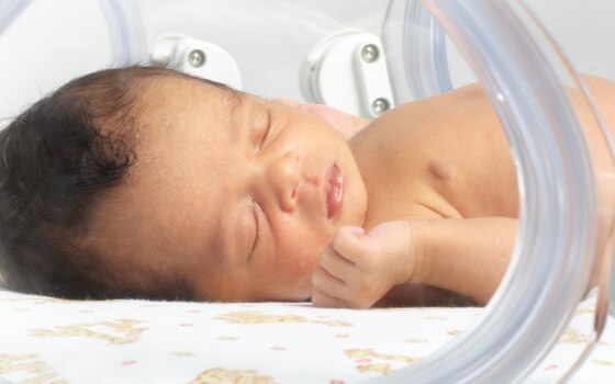 Giraffe OmniBed Carestation – Kombinierte Mikroumgebungen – Perinatale ...