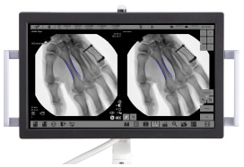 OEC MiniView | GE HealthCare (Germany)