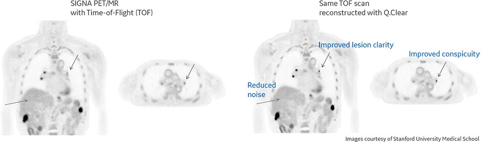SIGNA™ PET/MR mit QuantWorks – 60 cm | GE HealthCare (Germany)