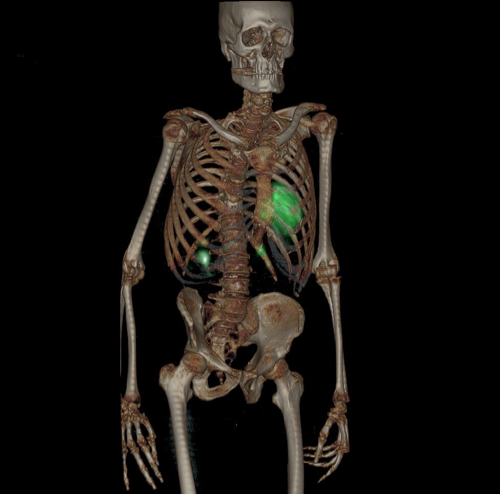 Volume Viewer | GE Healthcare (Germany)