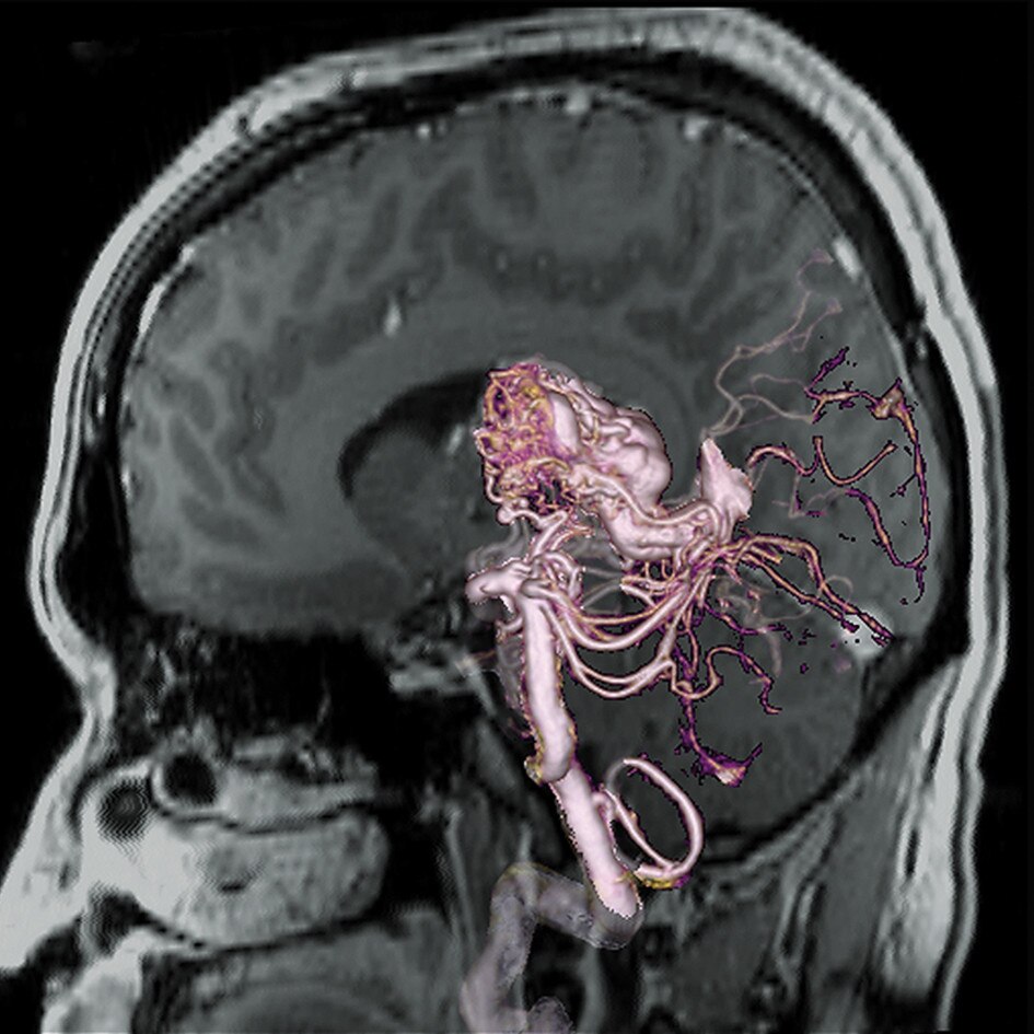 Innova CT HD | GE Healthcare (Germany)